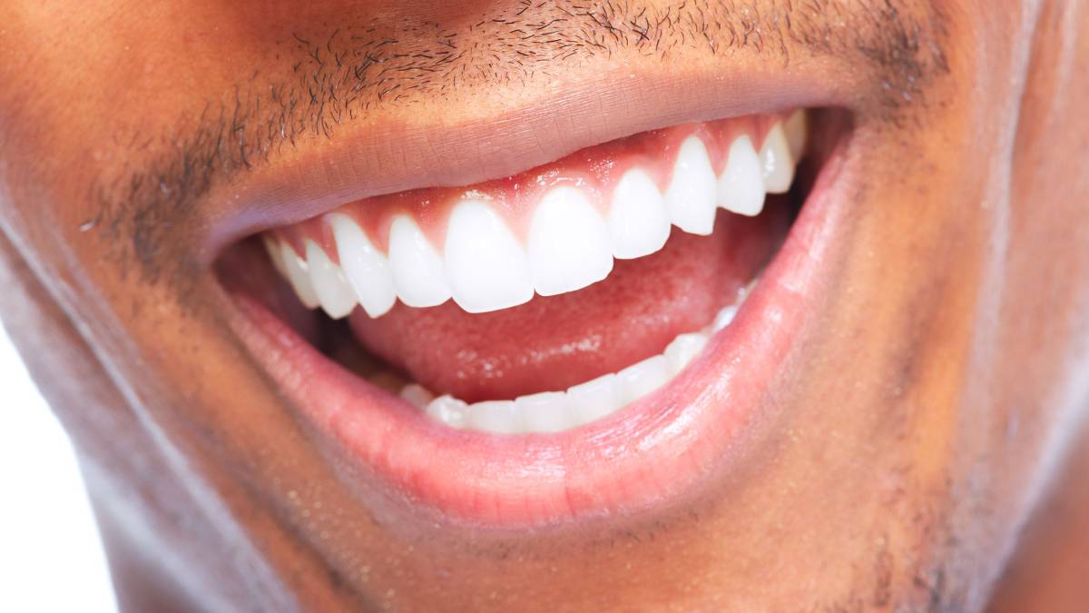 ¿Reconoces a cada artista por su sonrisa?
